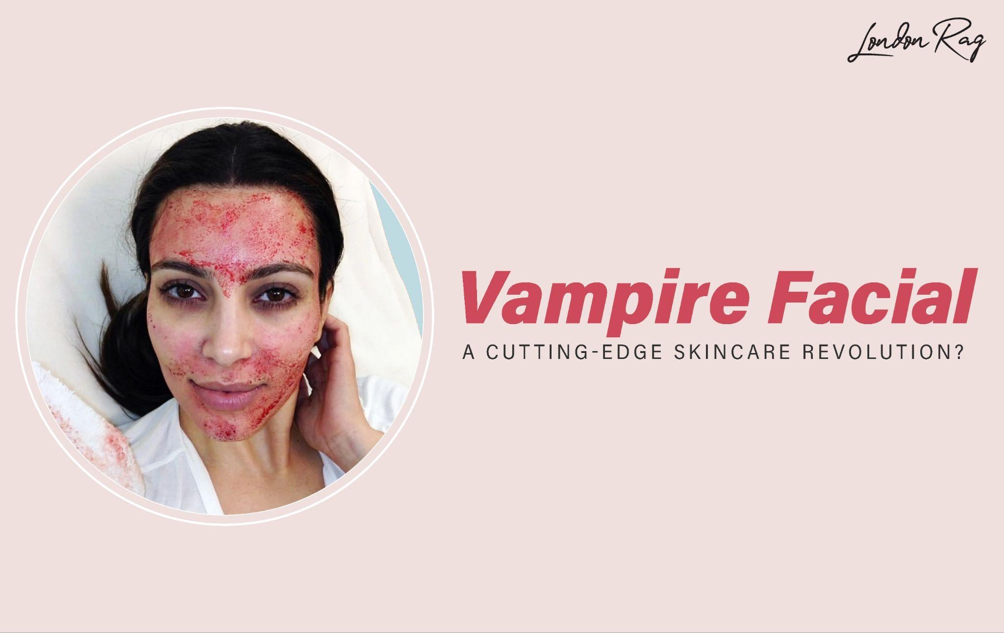 The Vampire Facial: A Cutting-Edge Skincare Revolution? – London Rag India